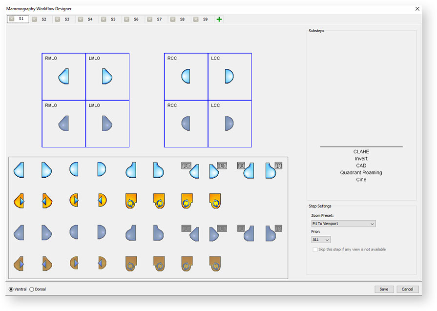 Digital Mammography and Tomosynthesis System | Candelis