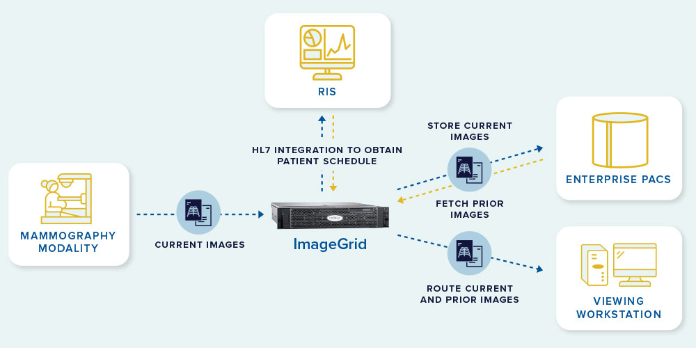 Digital Mammography and Tomosynthesis System | Candelis