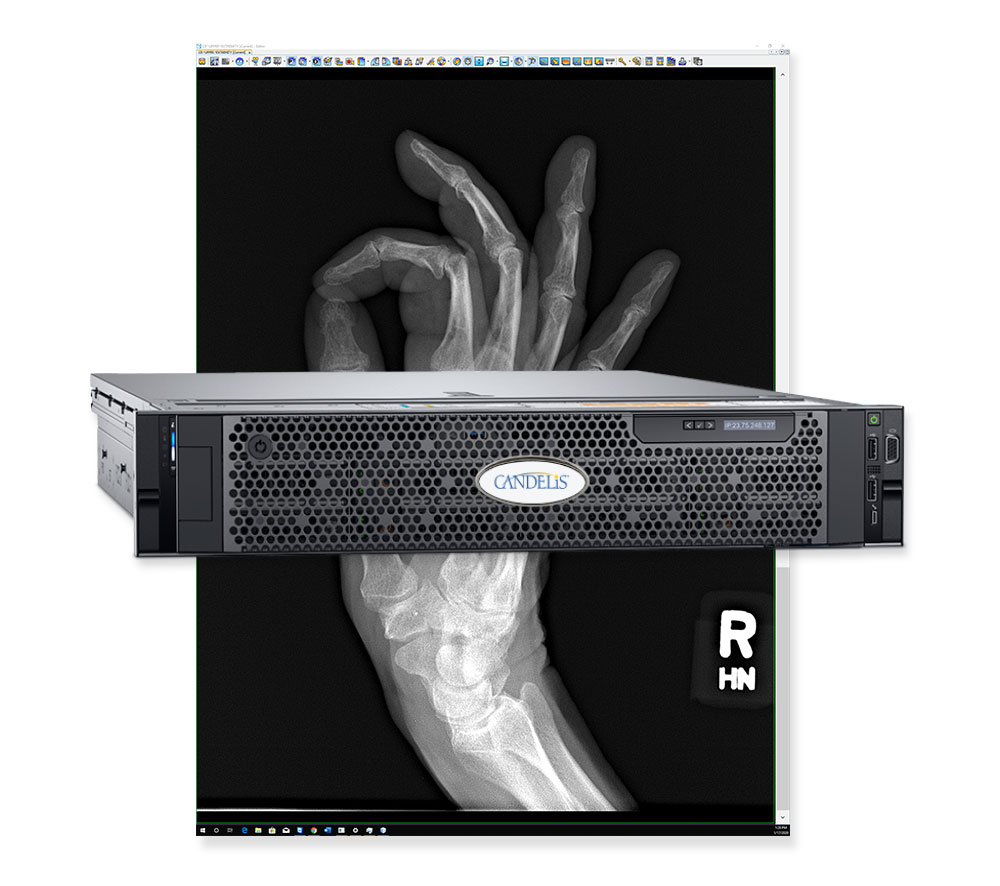 General Radiology | Candelis