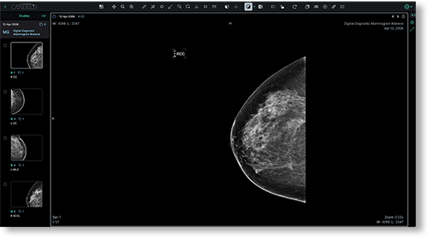 ImageGrid™ Universal Viewer | Candelis