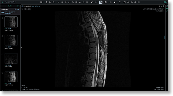 ImageGrid™ Universal Viewer | Candelis