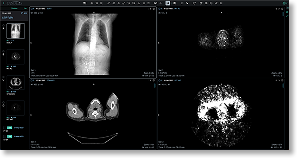 ImageGrid™ Universal Viewer | Candelis