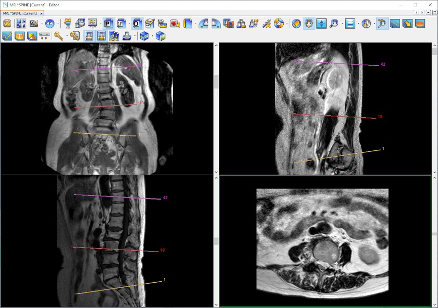 ImageView™ Advanced Radiology Viewer | Candelis